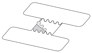 About Your Drainage Catheter with a Uresil Disk | Memorial Sloan ...