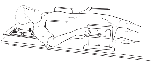 Image-Guided Radiation Therapy | Memorial Sloan Kettering Cancer Center