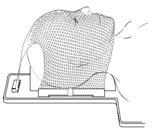 Image-Guided Radiation Therapy | Memorial Sloan Kettering Cancer Center