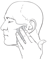 Trismus | Memorial Sloan Kettering Cancer Center