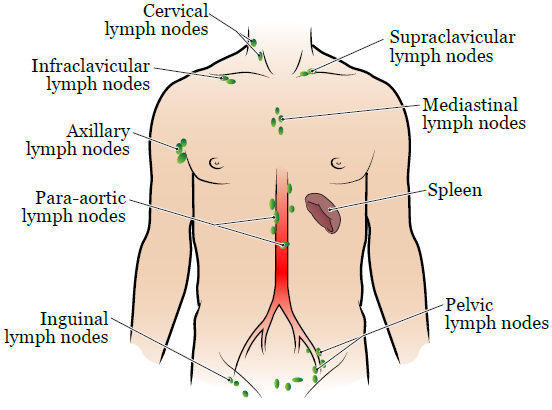 Supraclavicular Lymph Nodes Diagram