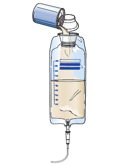 Tube Feeding With a Pump | Memorial Sloan Kettering Cancer Center