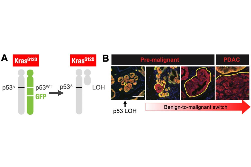The p53 Tumor Suppressor Network | Sloan Kettering Institute