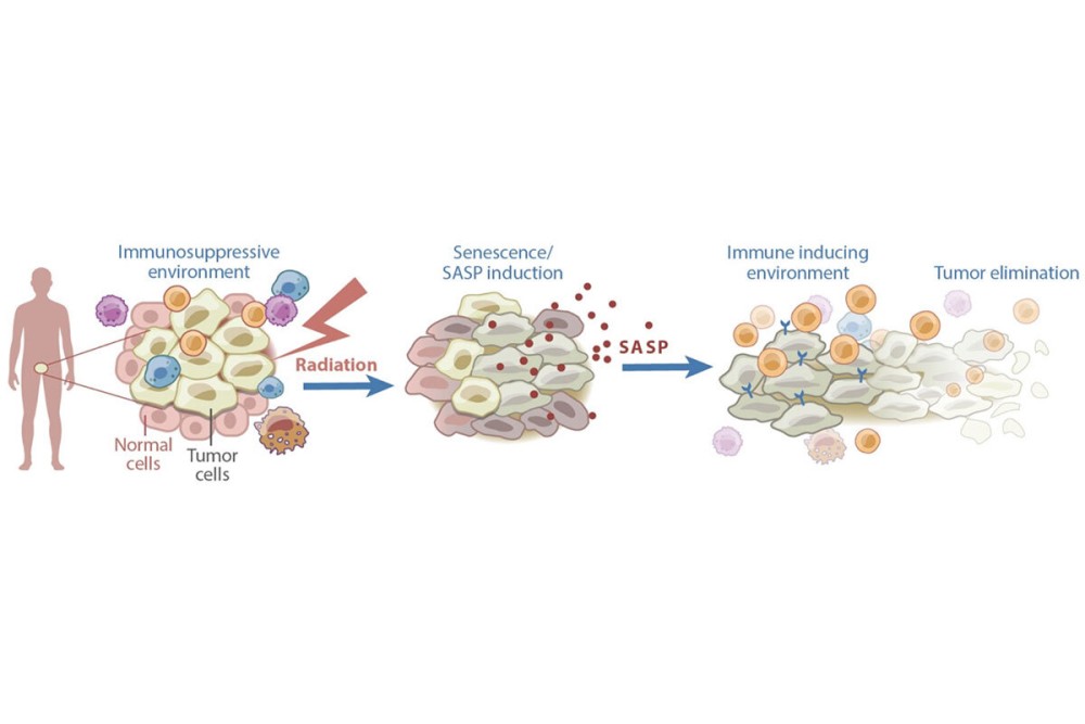 Understanding and Targeting Cellular Senescence | Sloan Kettering Institute
