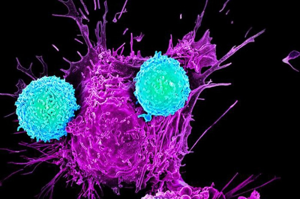 T Cell Attack: Taking Down Cancer with Immunotherapy | Memorial Sloan ...
