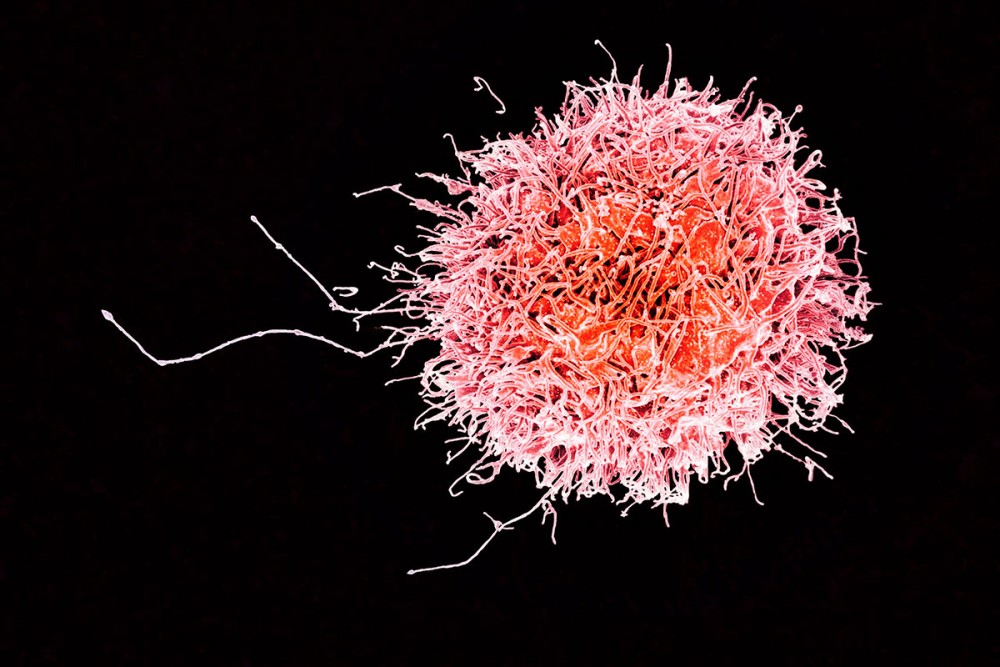 Drugs That Stall — But Don’t Kill — Cancer Cells Are an Untapped ...