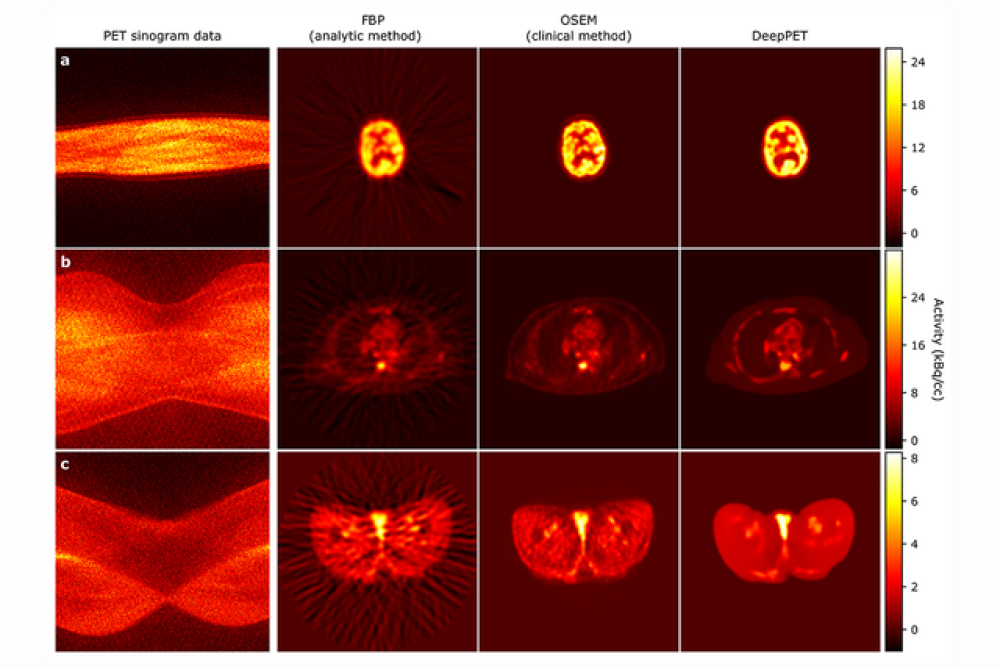DeepPET Uses Artificial Intelligence to Generate Images of the Body’s ...
