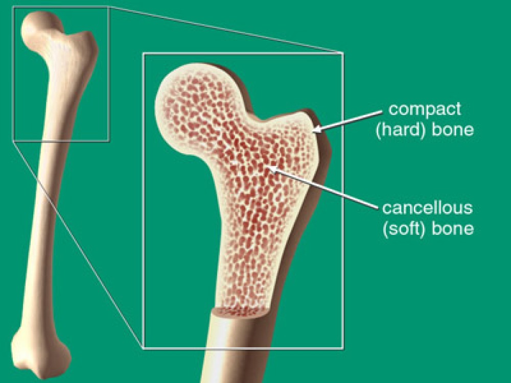 Image Bank: Bone | Memorial Sloan Kettering Cancer Center