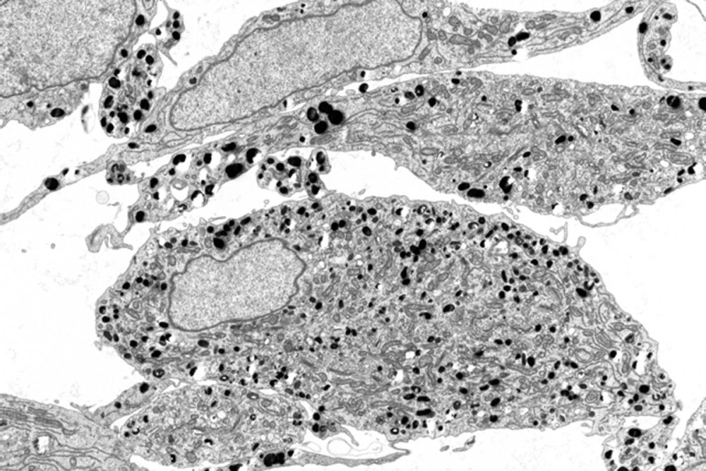 Pigment-Producing Skin Cells Generated Using Stem Cell Technology ...