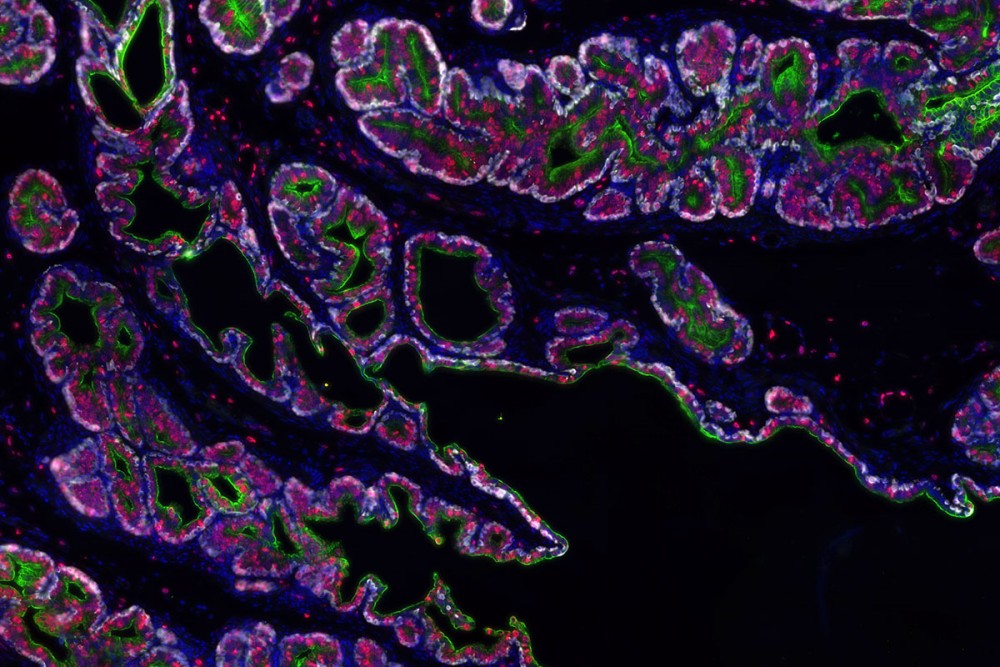 New Discovery Explains How the Prostate Gland Regenerates Itself ...