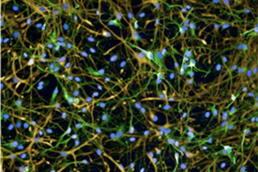 Genome Editing & Screening: Overview | Sloan Kettering Institute