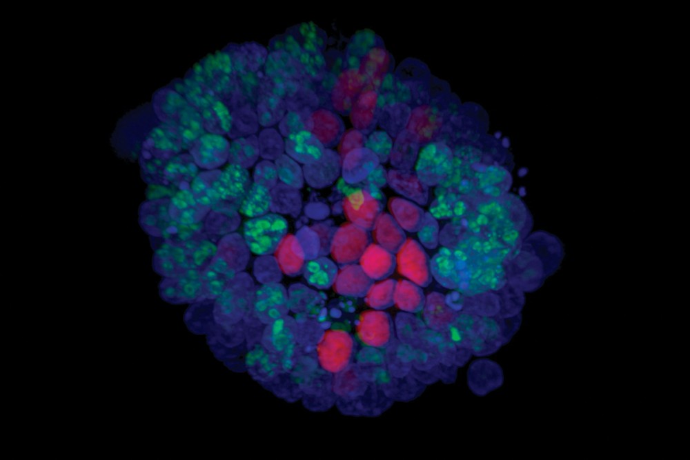 Unlocking a Mystery: What’s Behind the Rise In Colorectal Cancer Among ...