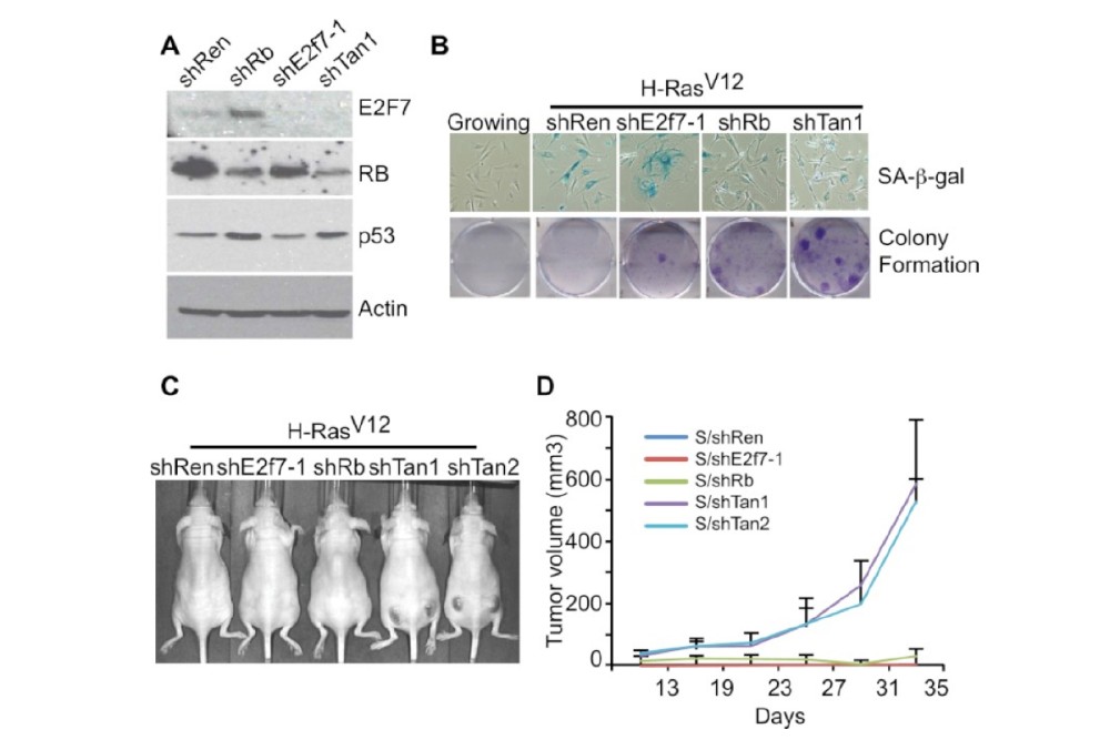 The p53 Tumor Suppressor Network | Sloan Kettering Institute