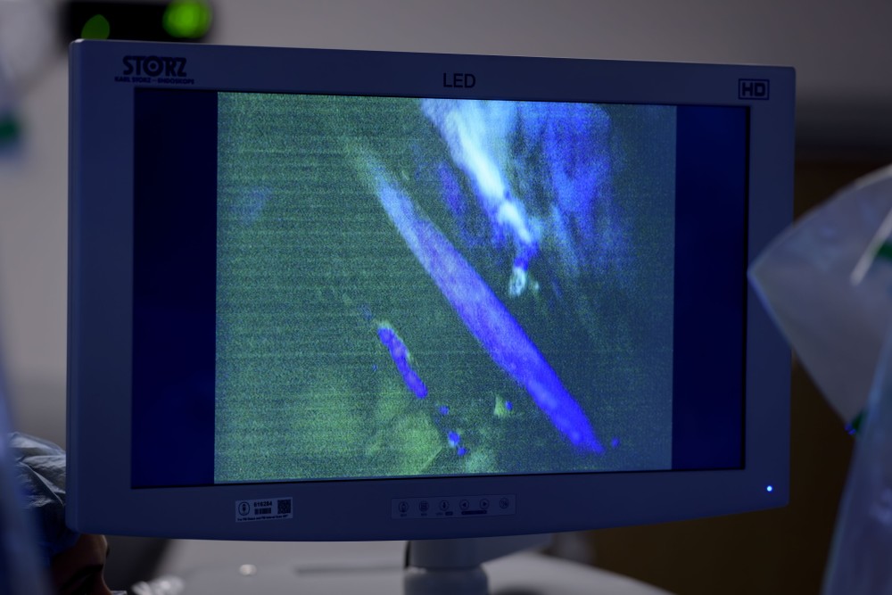 New Imaging Technique Could Reduce Side Effects of Prostate Cancer ...