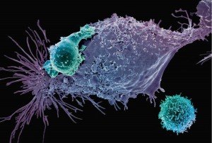 The Prasad Adusumilli Lab | Memorial Sloan Kettering Cancer Center