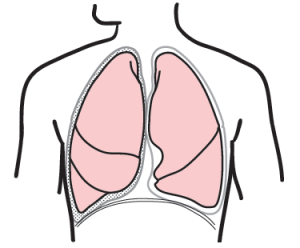 Información sobre su cirugía de tórax | Memorial Sloan Kettering Cancer ...