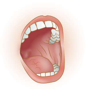 How to Take Pictures Showing Your Skin, Range of Motion, and Mouth ...