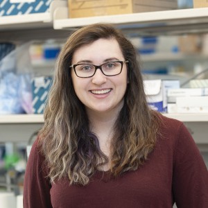 The Yael David Lab | Sloan Kettering Institute