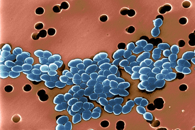 Researchers Identify a Bacterial Species That Could Protect against ...
