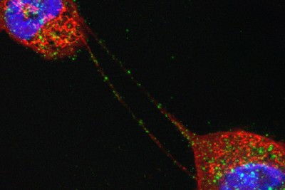 Cell Signaling & Regulation | Memorial Sloan Kettering Cancer Center