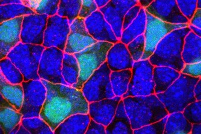 The Marie-Josée and Henry R. Kravis Cancer Ecosystems Project ...