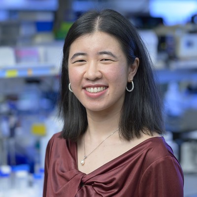 The Yueming Li Lab | Sloan Kettering Institute