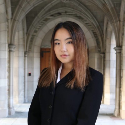 The Xiaolan Zhao Lab | Sloan Kettering Institute