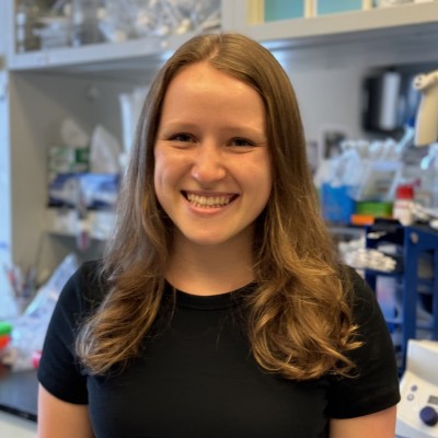 The Lydia Finley Lab | Sloan Kettering Institute