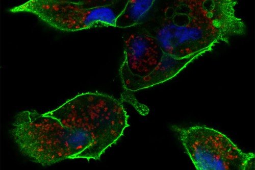 License to Build: New Theory of Cancer Puts Metabolism at Center ...