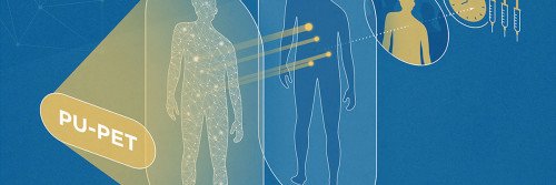 Theranostics: A Smart Bomb for Cancer | Memorial Sloan Kettering Cancer ...