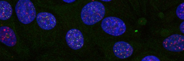 Imaging | Memorial Sloan Kettering Cancer Center