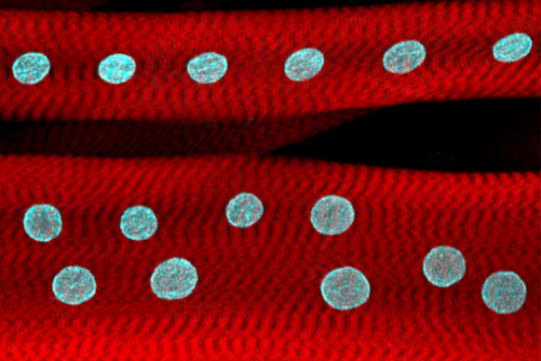 Scientists Home In On “Equation” for Muscle Cell Size | Memorial Sloan ...