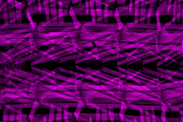 Scientists Home In On “Equation” for Muscle Cell Size | Memorial Sloan ...