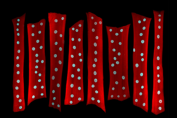 Scientists Home In On “Equation” for Muscle Cell Size | Memorial Sloan ...