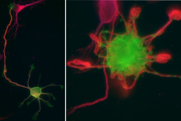 Researchers Identify Key Element of Nerve Cell Development | Memorial ...