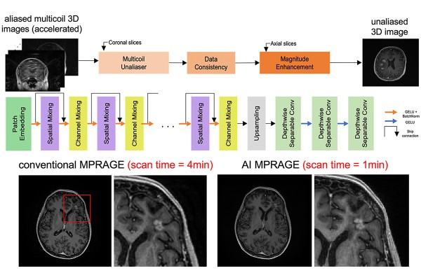 The Ricardo Otazo Lab: Fast MRI using artificial intelligence | Memorial Sloan Kettering Cancer ...