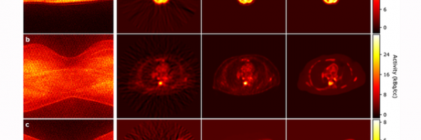 CT Scan vs. MRI: What’s the Difference? | Memorial Sloan Kettering ...