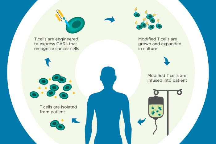 CAR T Cell Therapies Are a Growing Area of Research | Memorial Sloan ...
