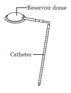 About Your Ommaya Reservoir Placement Surgery for Pediatric Patients ...