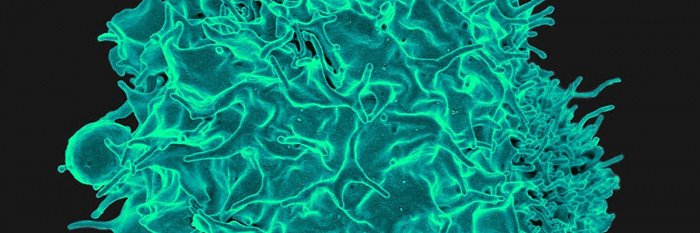 Immune Checkpoint Inhibitor Cancer Treatment | Memorial Sloan Kettering ...