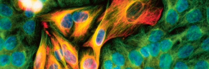 Skin Cancer: Mohs Surgery and Other Dermatologic Surgeries | Memorial ...