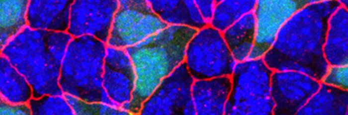 One by One: Single-Cell Analysis Helps Map the Cancer Landscape ...