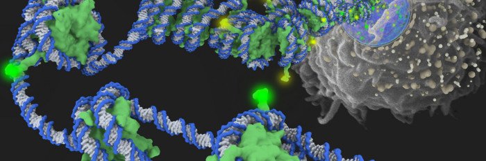 Treatment for Acute Myeloid Leukemia (AML) | Memorial Sloan Kettering ...