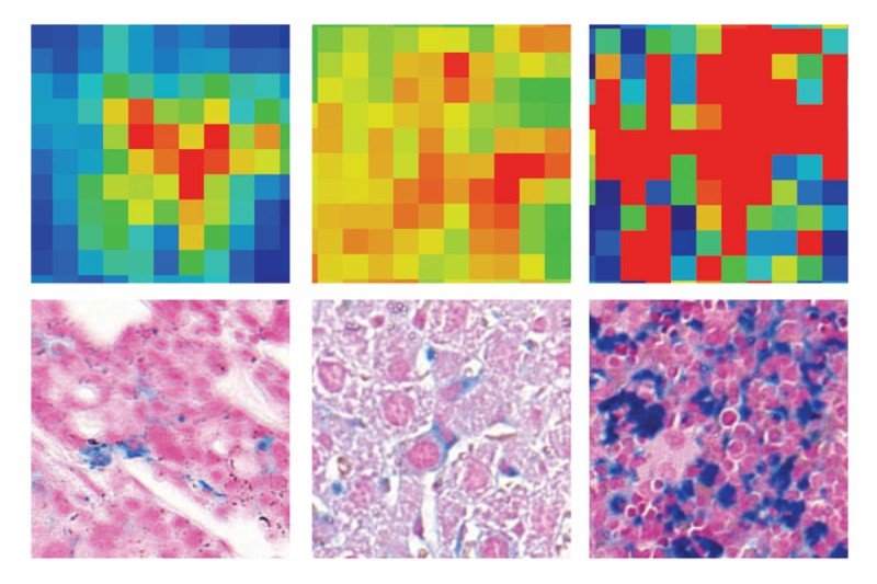 MSK-Developed Technology Provides a “Virtual Biopsy” of Immune Cells in ...