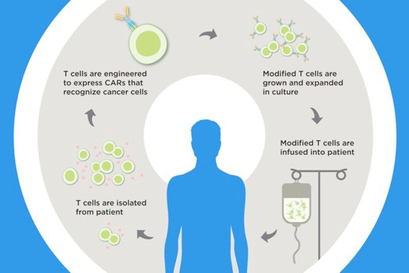 Study Identifies New Way to Combat a Serious CAR T Cell Therapy Side ...