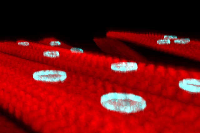 Scientists Home In On “Equation” for Muscle Cell Size | Memorial Sloan ...