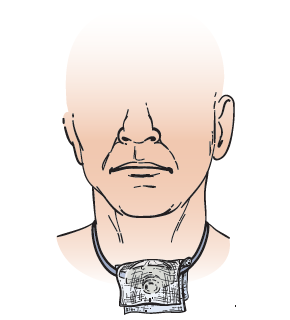 Caring for Your Tracheostomy | Memorial Sloan Kettering Cancer Center