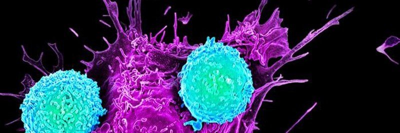 Prasad S. Adusumilli, MD, FACS - MSK Thoracic Surgeon & Cellular Therapist