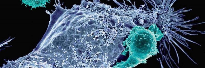 Types of Cancer Treatments: CAR T Cell Therapy | Memorial Sloan ...