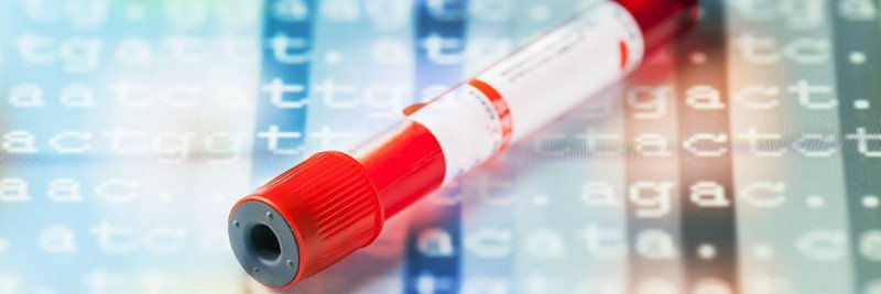 MSK Discovery of ESR1 Gene Mutation Leads to Approval of Breast Cancer ...